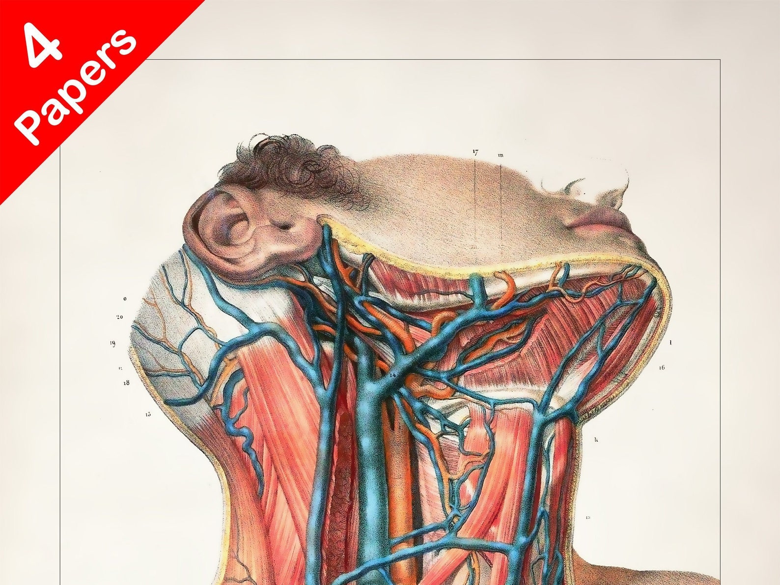 CAROTID NECK ARTERY Anatomy Art Print for Medical Student Graduate ...