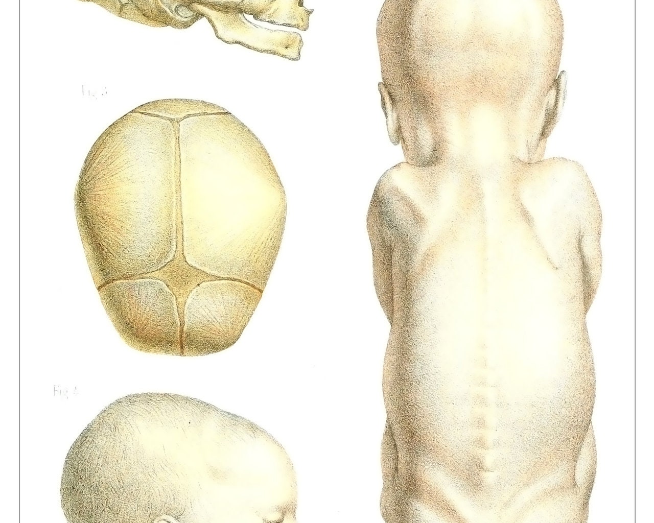 FETUS NEONAT INFANT Anatomy Art Print for Medical Student Graduate ...