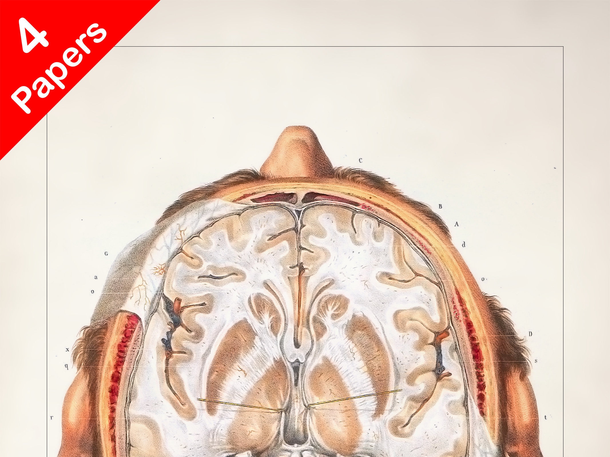 BRAIN HORIZONTAL VIEW Anatomy Art Print for Medical Student Graduate ...