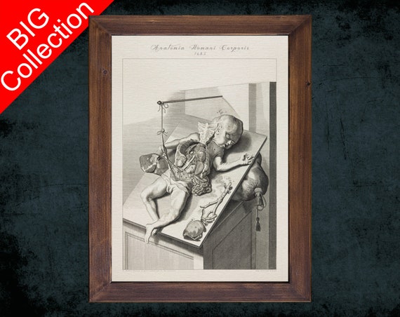 Human Anatomy Art Print BABY DISSECTION AUTOPSY Anatomical | Etsy