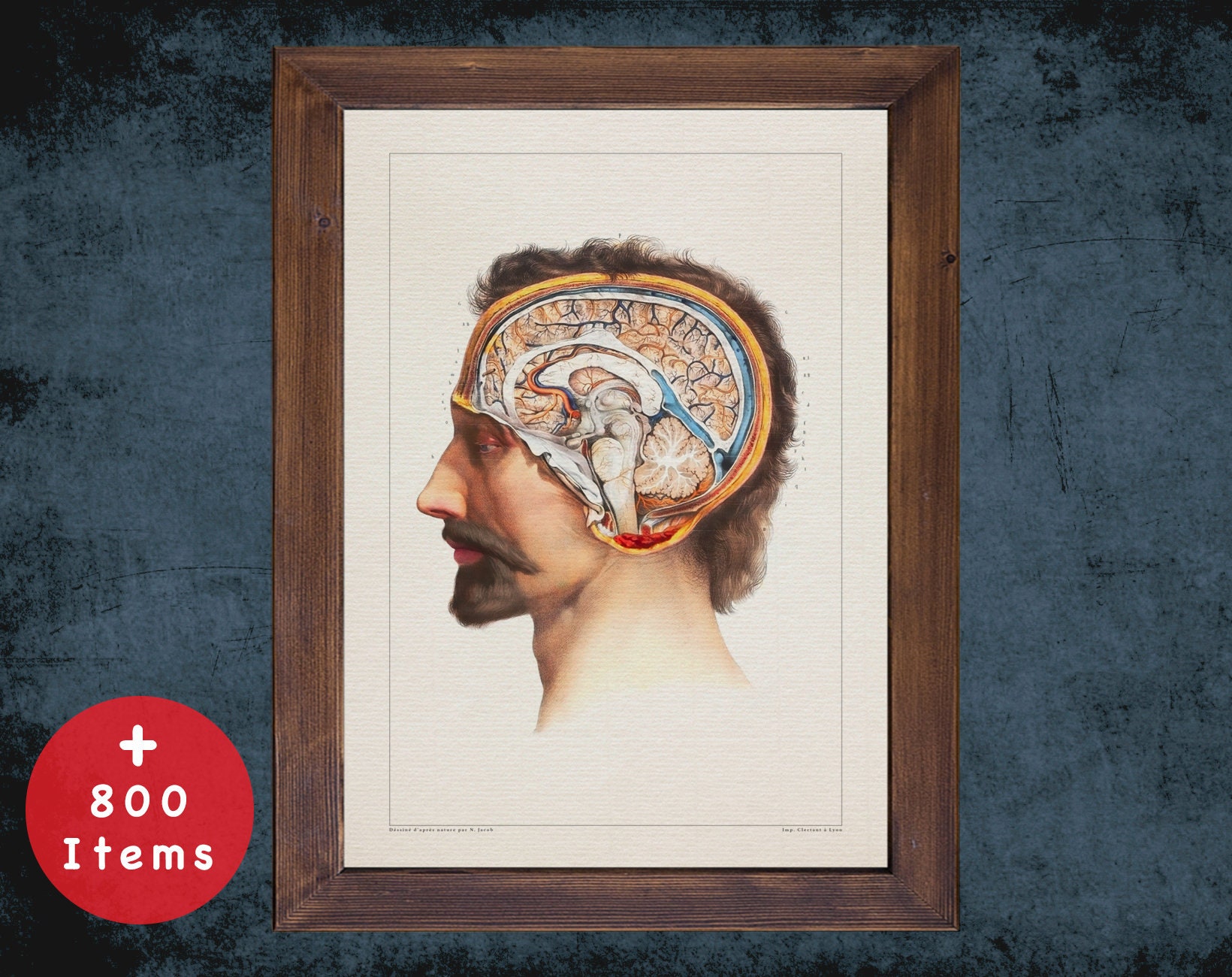 Anatomy Print, Set of 6 Posters, Gift for Neurosurgeon Doctor ...