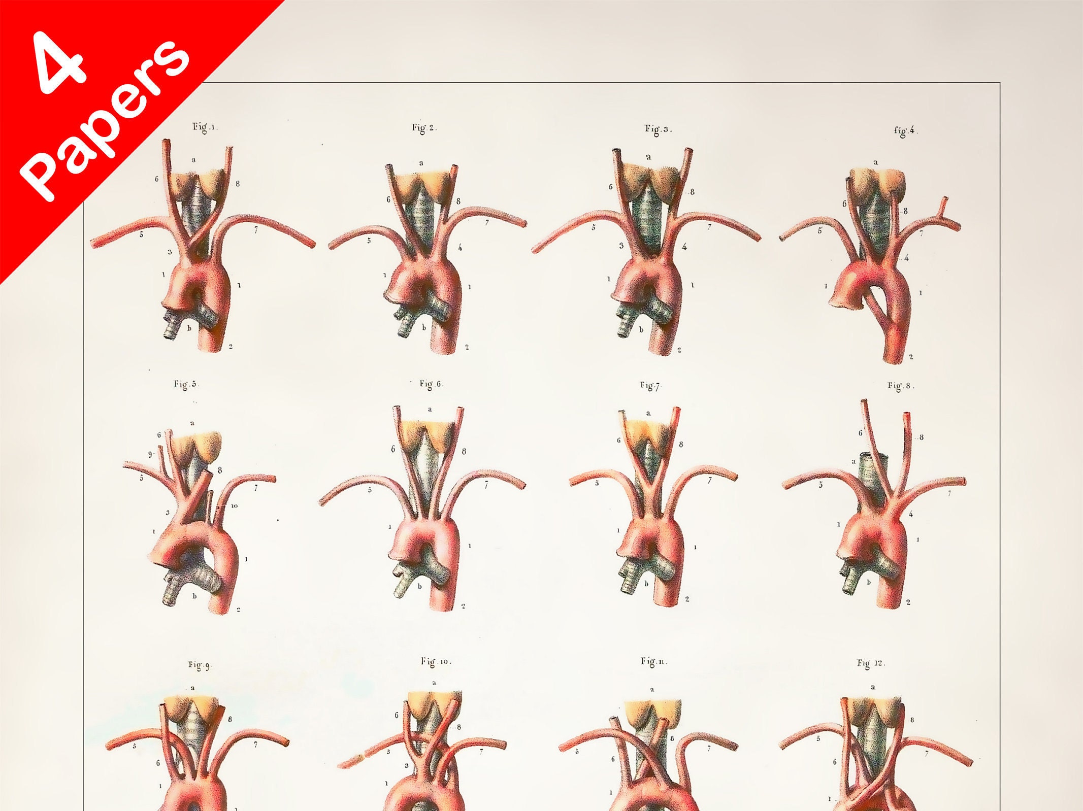 AORTA ARTERY HEART Anatomy Art Print for Medical Student Graduate ...