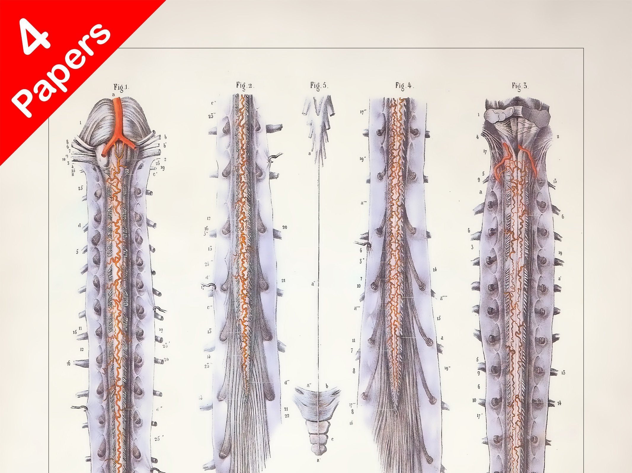 DENTICULATE LIGAMENTS SPINE Anatomy Art Print for Medical Student ...
