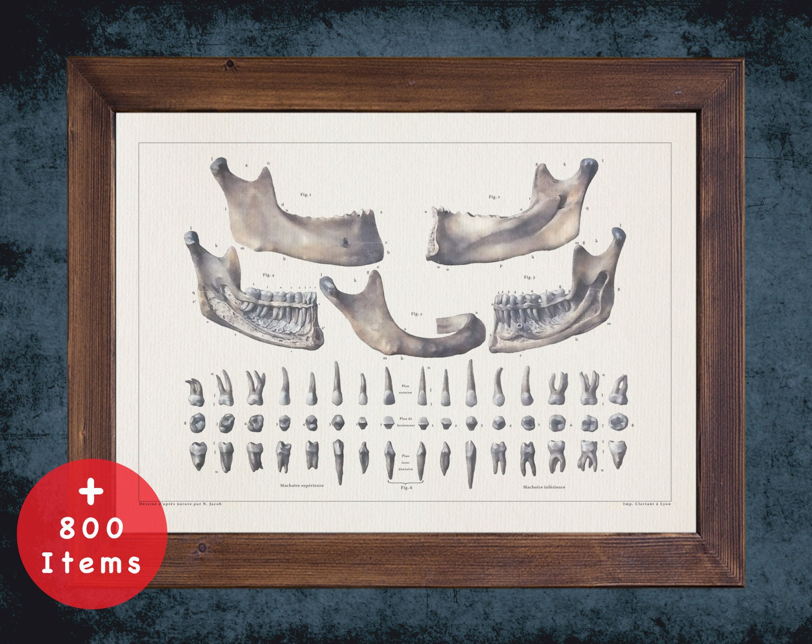 TEETH MANDIBLE ROOT Anatomy Art Print for Medical Student Graduate ...