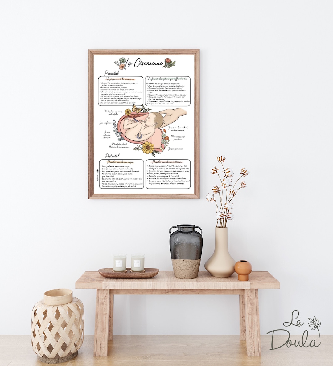 Poster/ Poster/ Cesarean Section / Clinic Midwife Birth - Etsy