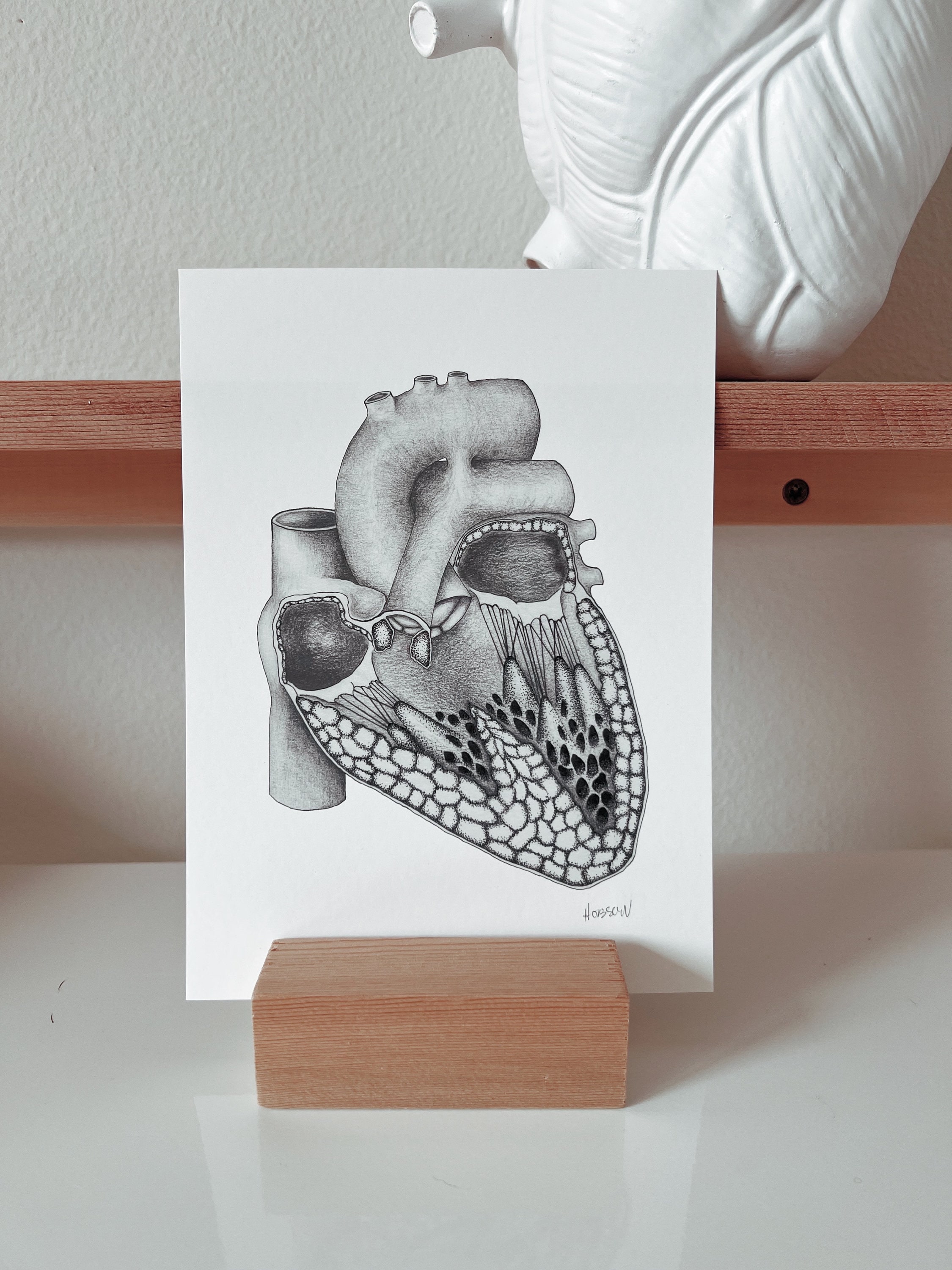 Tetralogy of Fallot Print - Anatomical Heart Drawing - Cardiology Gift ...