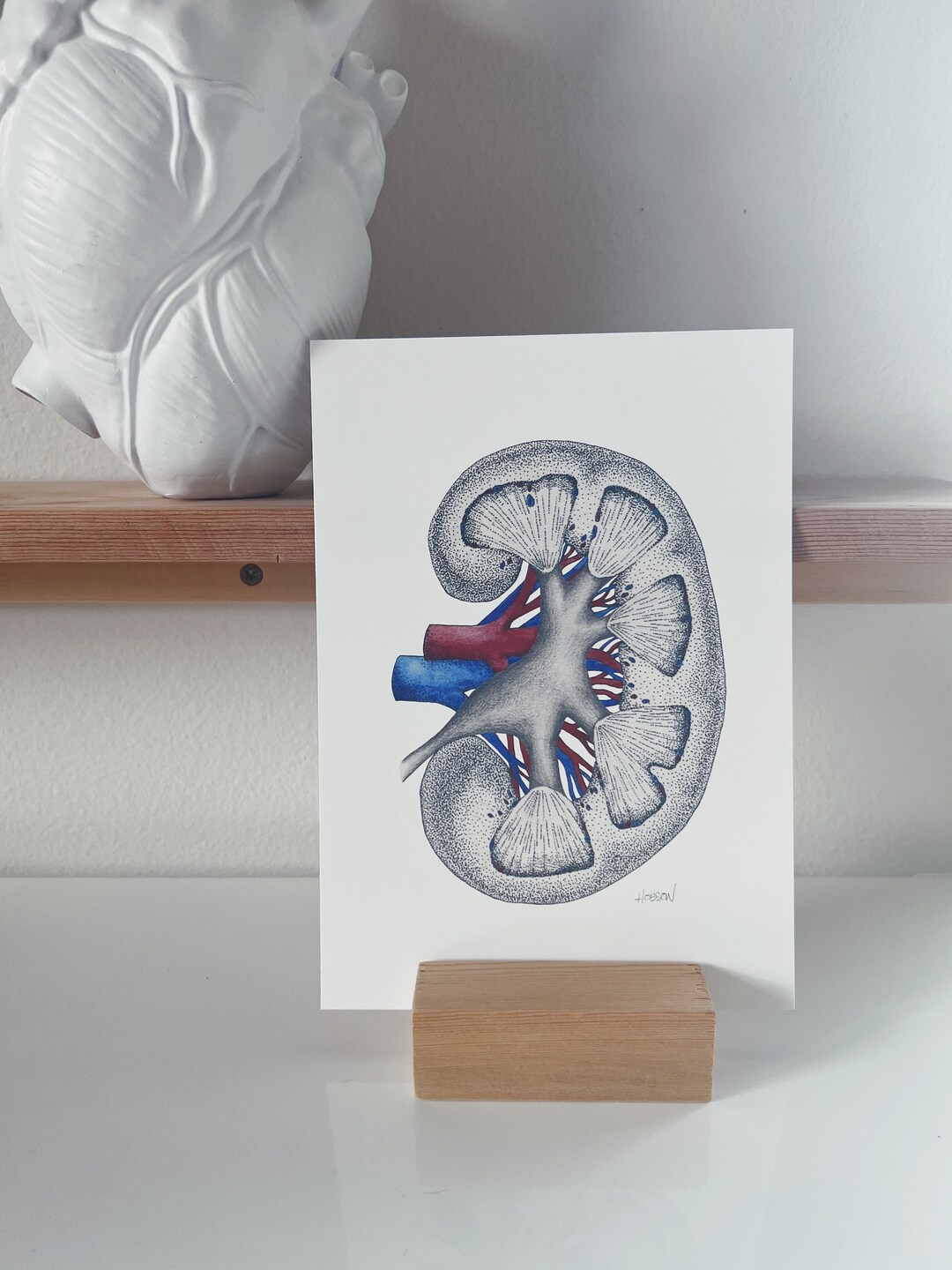 Kidney Anatomy Drawing - Nephrology Art - Kidney Transplant Gift ...
