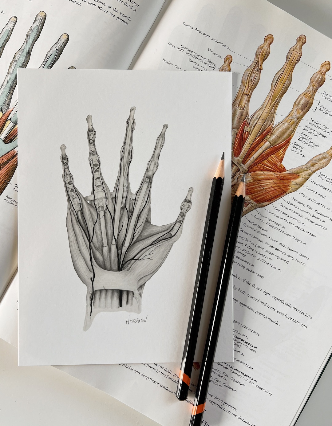 Anatomical Hand Drawing - Anatomy Art- Hand Surgeon Gift - Orthopedics ...