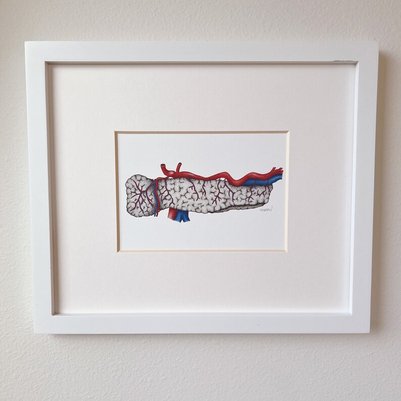 Pancreas Anatomy Drawing - Diabetes Art - Endocrinology Art - Medical ...