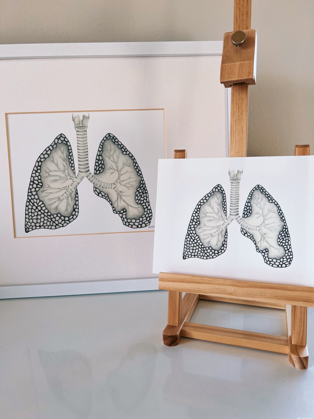 Lung Anatomy Drawing - Anatomical Image - Pulmonology Art - Physician ...