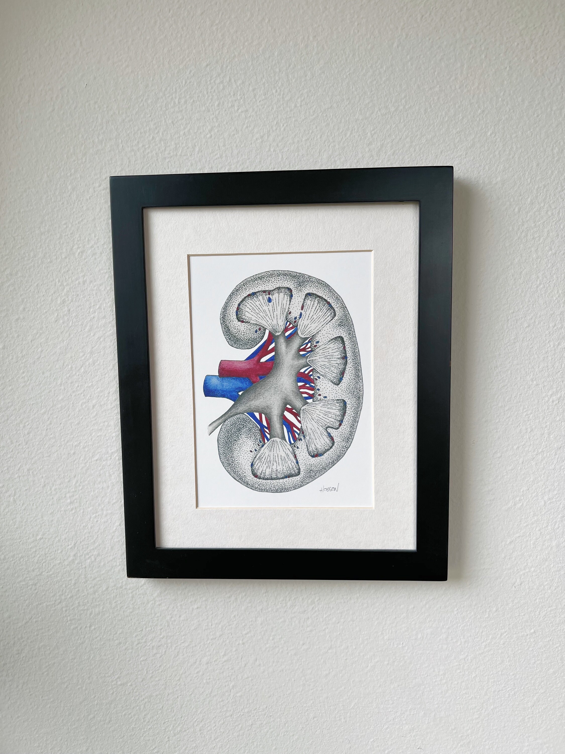 Kidney Anatomy Drawing - Nephrology Art - Kidney Transplant Gift ...