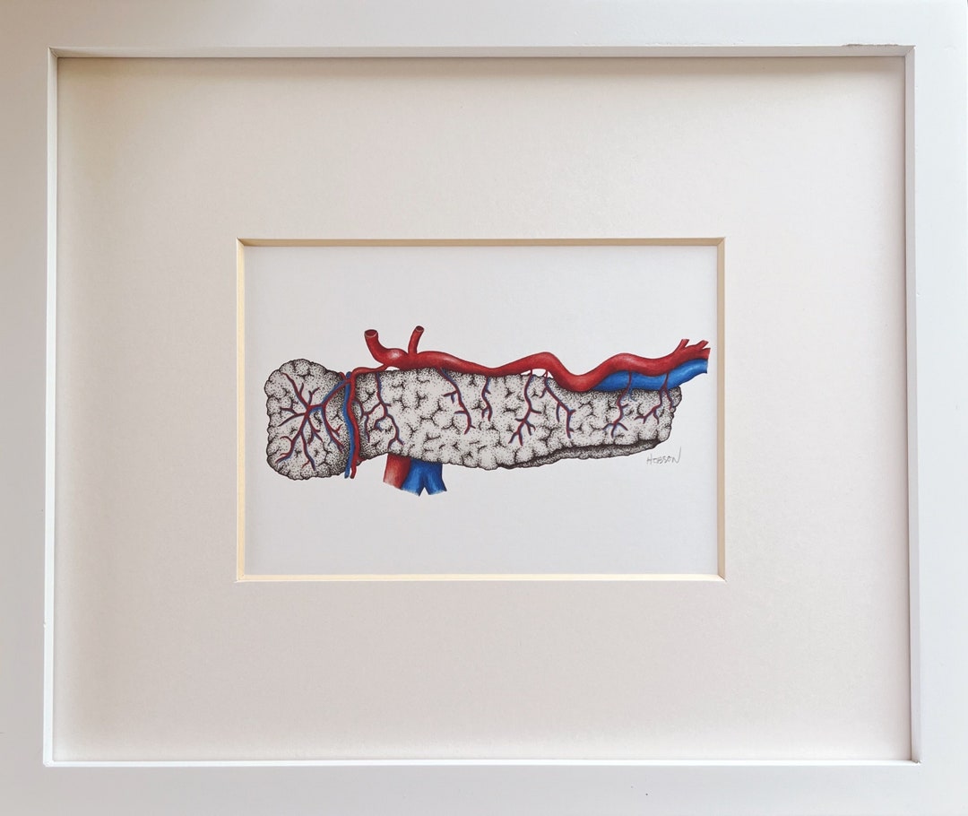 Pancreas Anatomy Drawing - Diabetes Art - Endocrinology Art - Medical ...