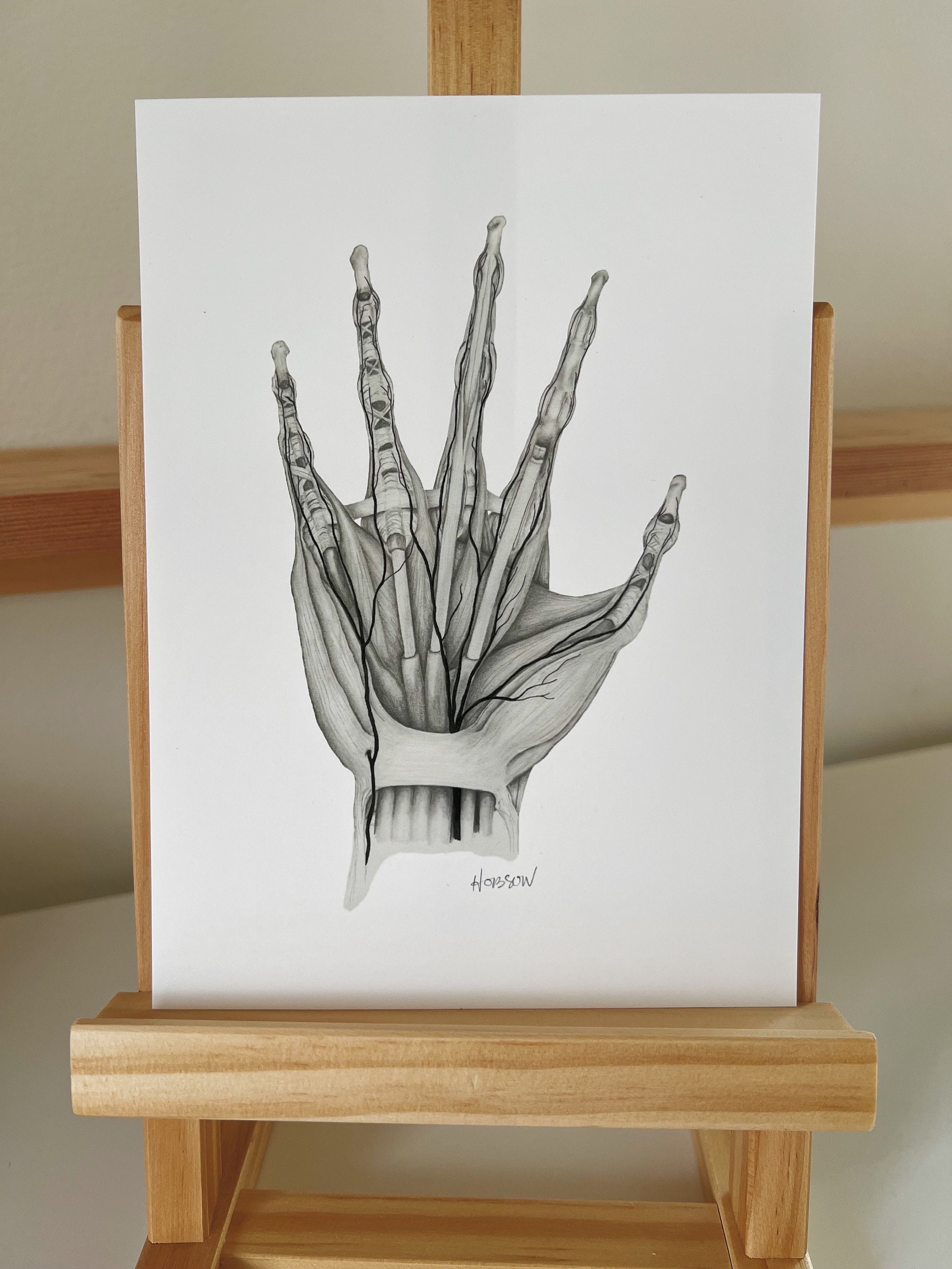 Anatomical Hand Drawing - Anatomy Art- Hand Surgeon Gift - Orthopedics ...