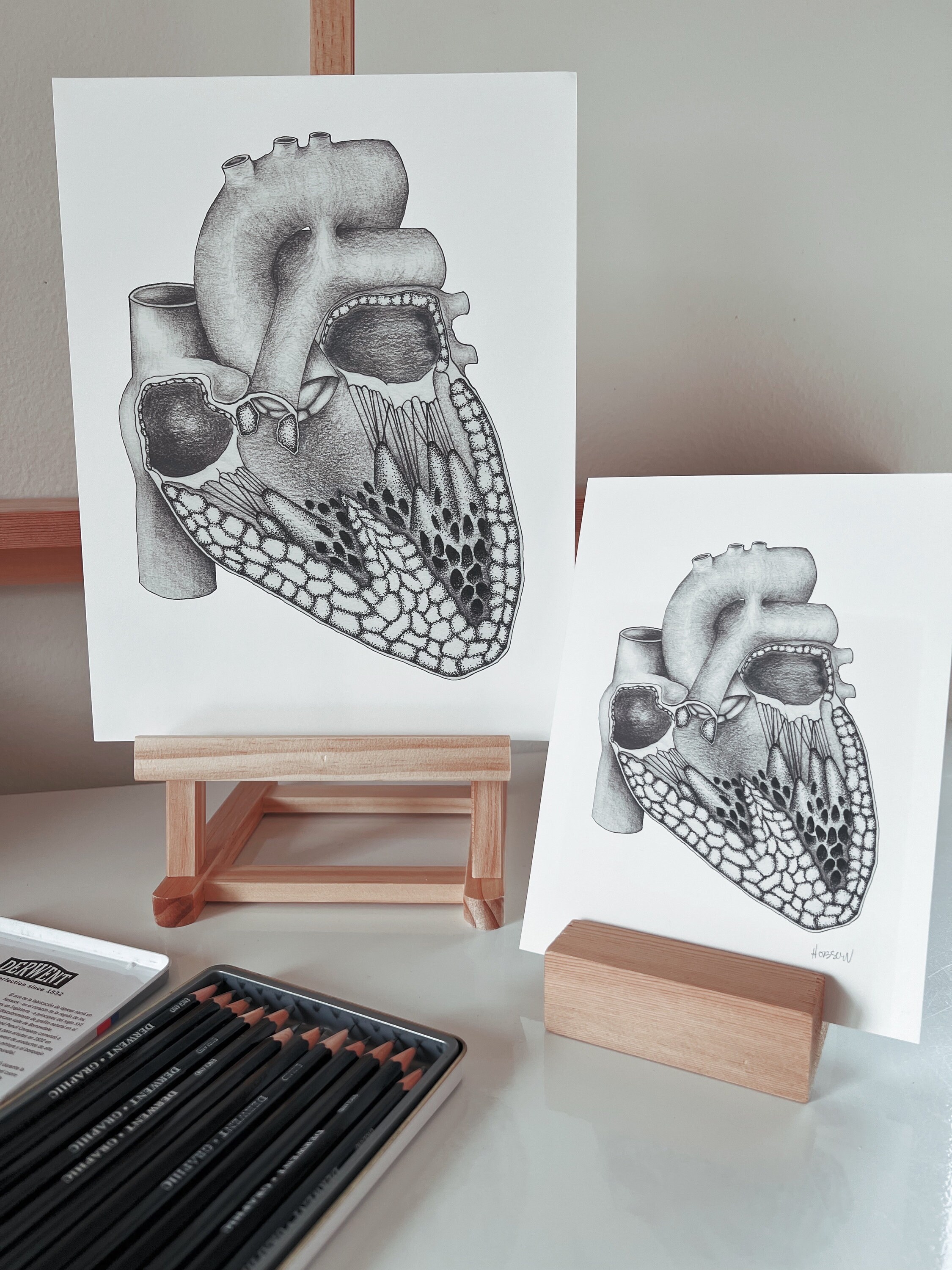 Tetralogy of Fallot Print - Anatomical Heart Drawing - Cardiology Gift ...