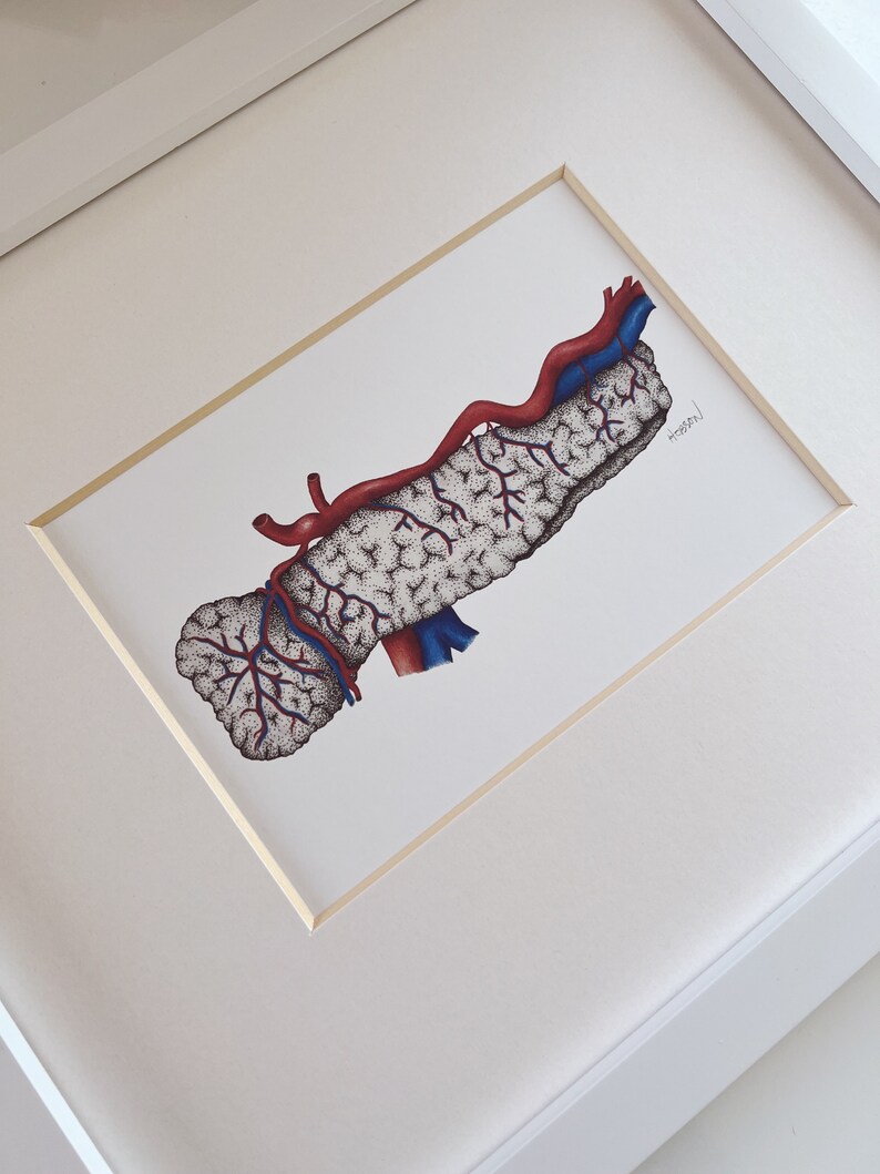 Pancreas Anatomy Drawing - Diabetes Art - Endocrinology Art - Medical ...