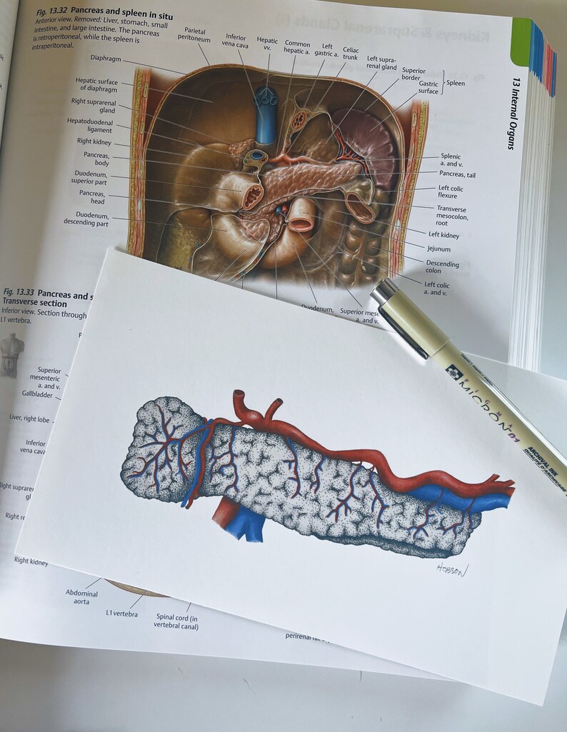 Pancreas Anatomy Drawing - Diabetes Art - Endocrinology Art - Medical ...