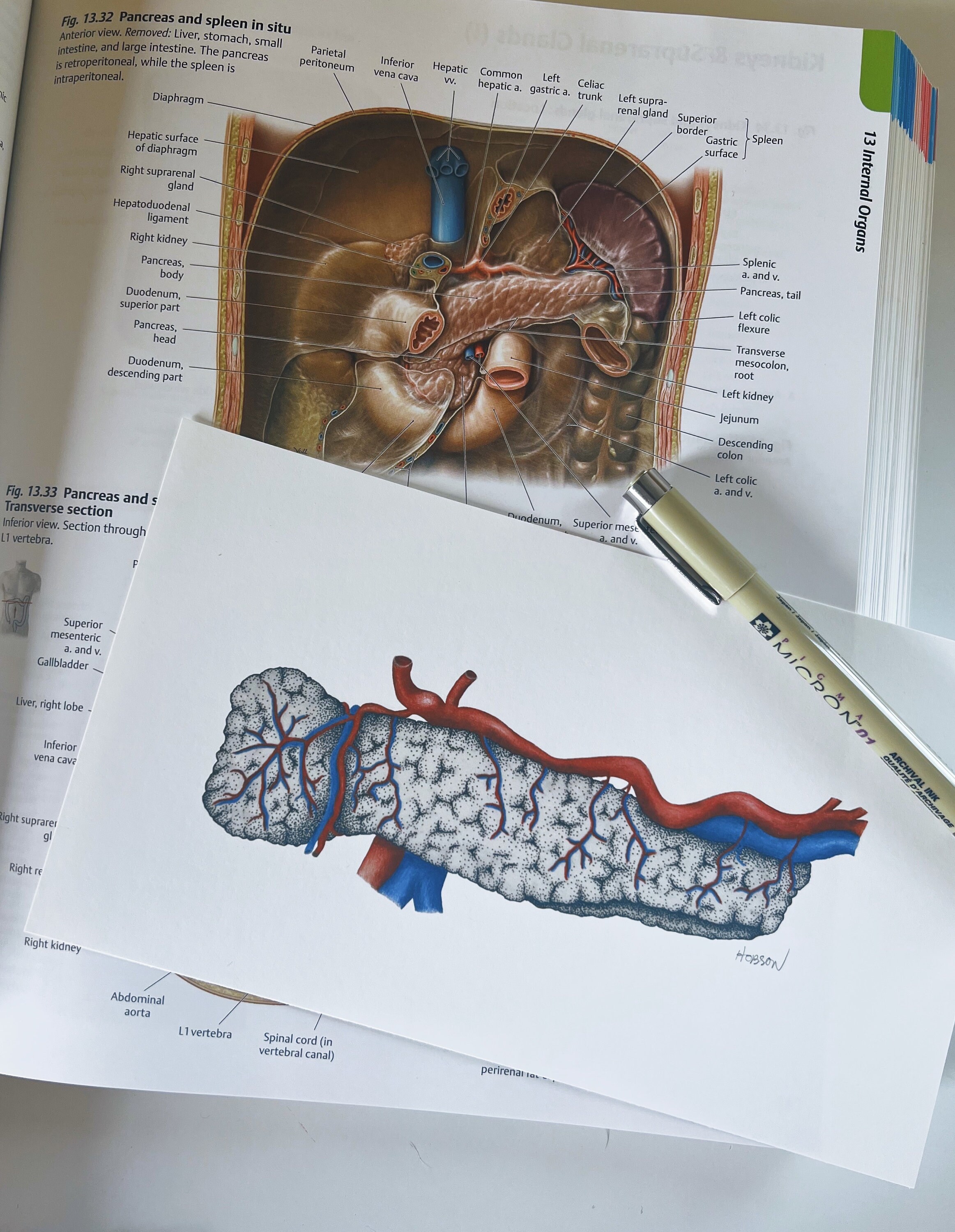 Pancreas Anatomy Drawing - Diabetes Art - Endocrinology Art - Medical ...