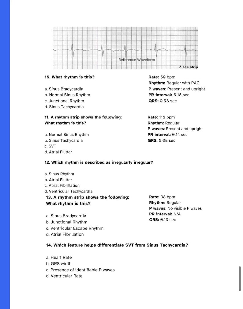 EKG Interpretation Guide & Quizzes | Beginner Nursing Students ...