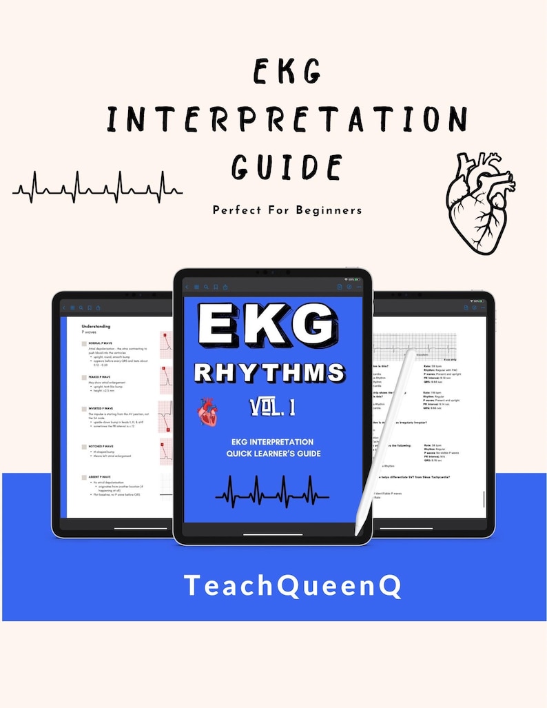 EKG Interpretation Guide & Quizzes | Beginner Nursing Students ...