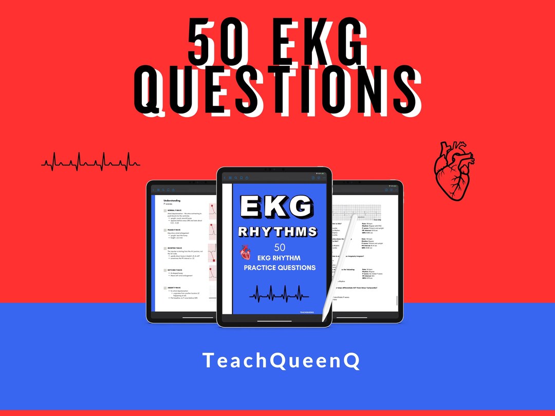 EKG Rhythm Quiz | 50 Monitor Tech Exam Questions (PDF Study Guide ...