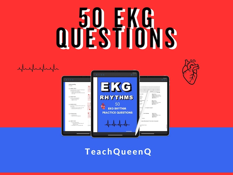 EKG Rhythm Quiz | 50 Monitor Tech Exam Questions (PDF Study Guide ...