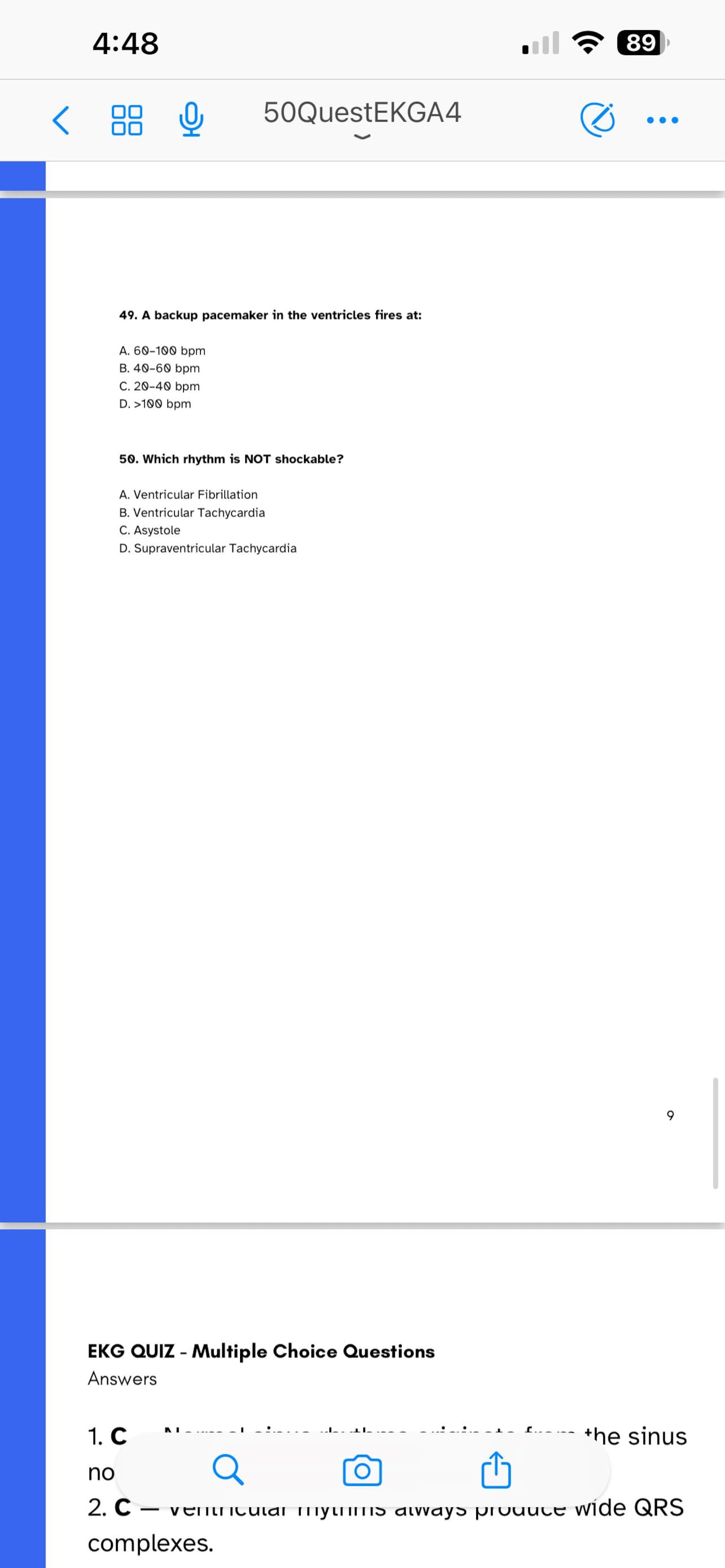 EKG Rhythm Quiz | 50 Monitor Tech Exam Questions (PDF Study Guide ...