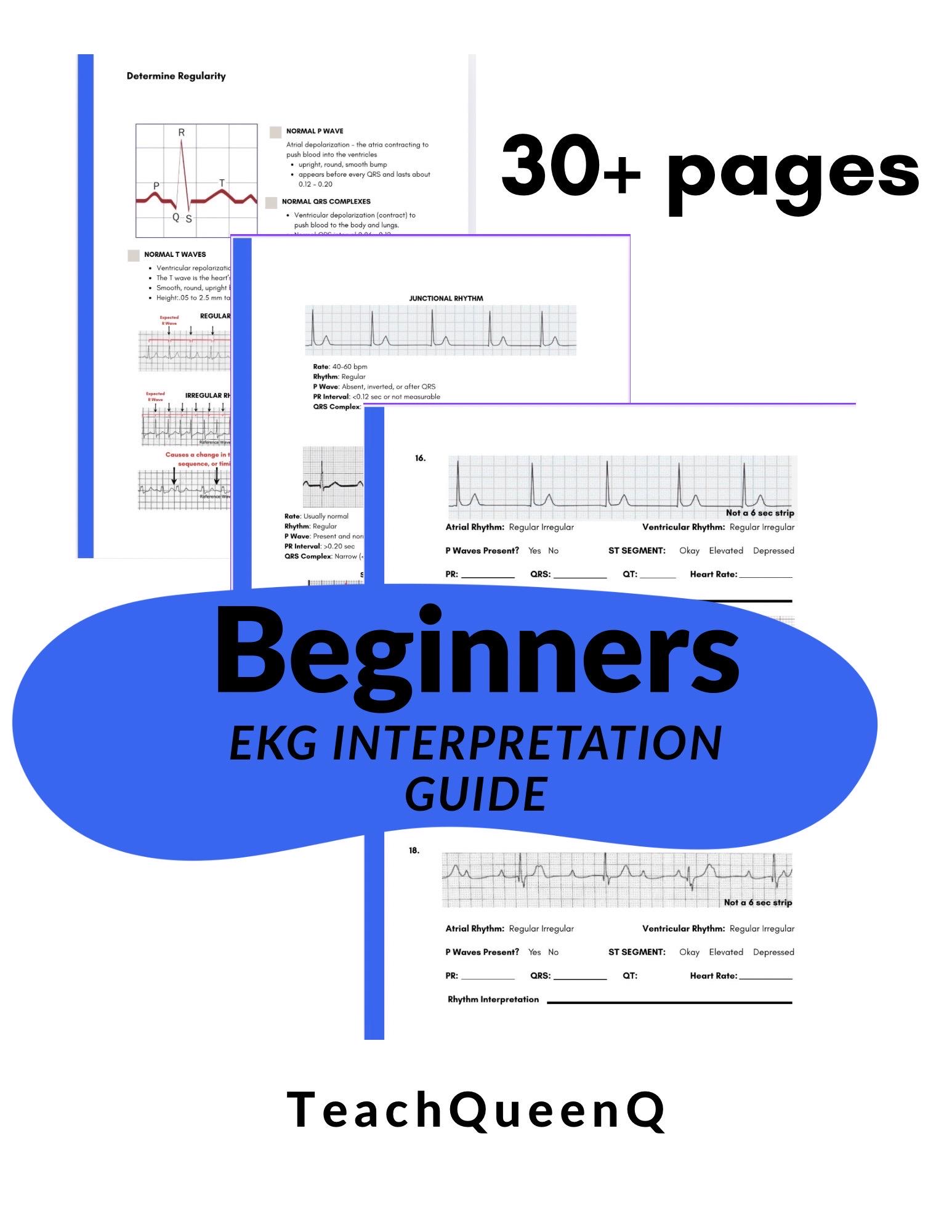 EKG Interpretation Guide & Quizzes | Beginner Nursing Students ...