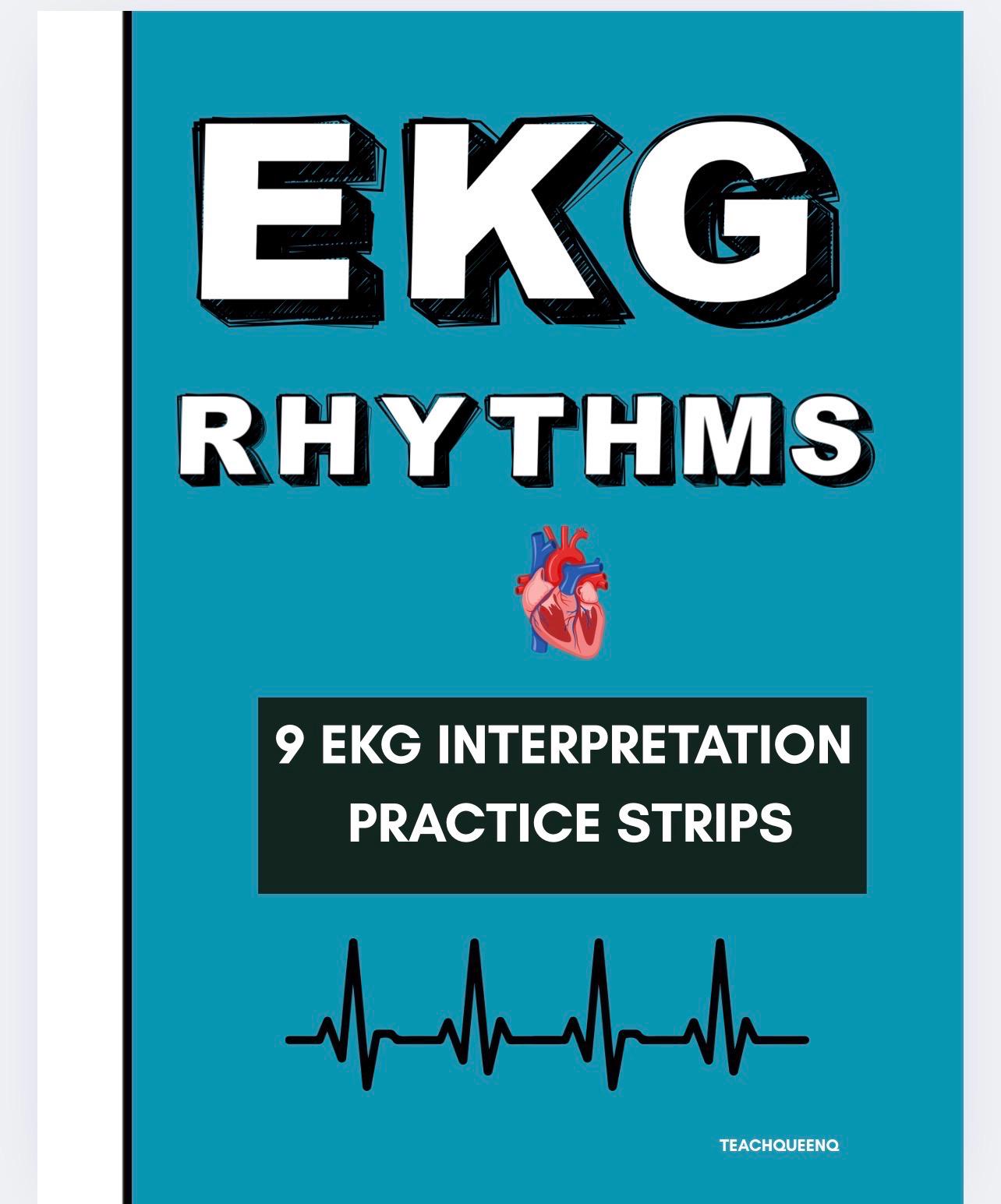 EKG Strip Interpretation Quiz | 9 Rhythm Practice Strips | Monitor Tech ...