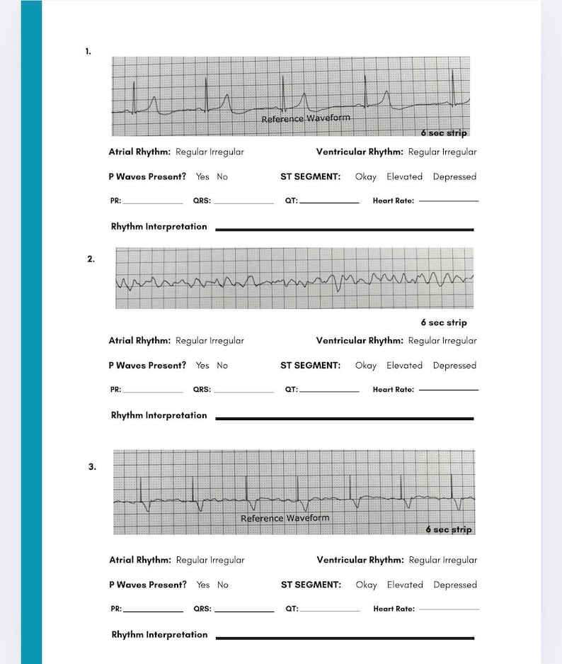 EKG Strip Interpretation Quiz | 9 Rhythm Practice Strips | Monitor Tech ...