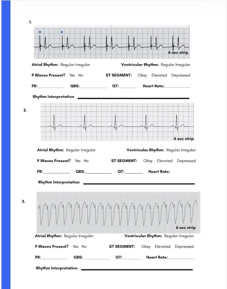 EKG Interpretation Guide & Quizzes | Beginner Nursing Students ...