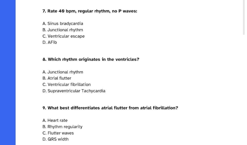 50 EKG Rhythm Practice Questions | Monitor Tech Exam Prep | Telemetry ...