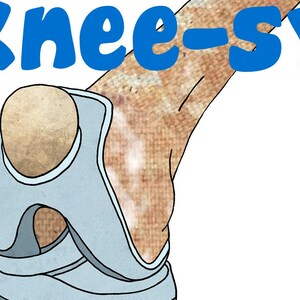 Personalised Knee Replacement Surgery Greeting Card, Get Well Card, Personalised, Take It Nice ...