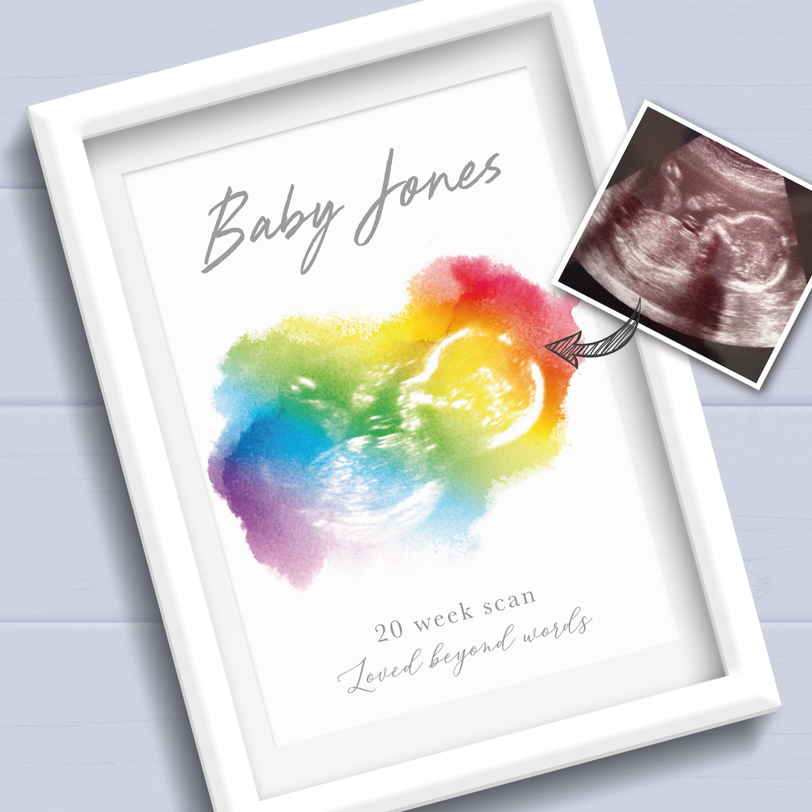 Rainbow Baby Scan Print. Ultrasound or Sonogram Art Print. - Etsy UK