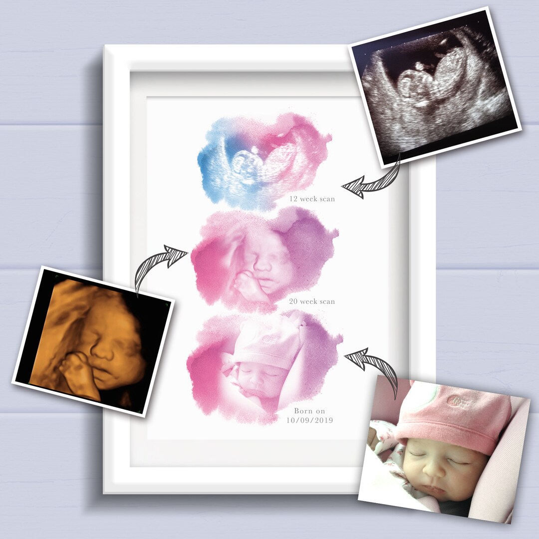 Baby Scan Print Keepsake With 3 Scan Images. Personalised Gift for Mum ...