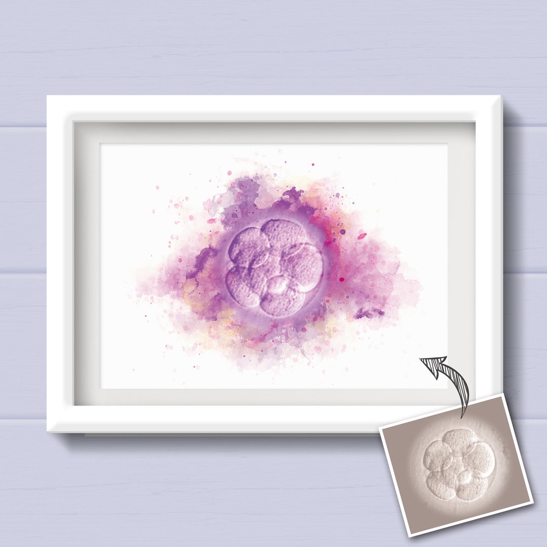 Watercolour IVF Embryo Art Print. Nursery Art Decor. Personalised Baby ...
