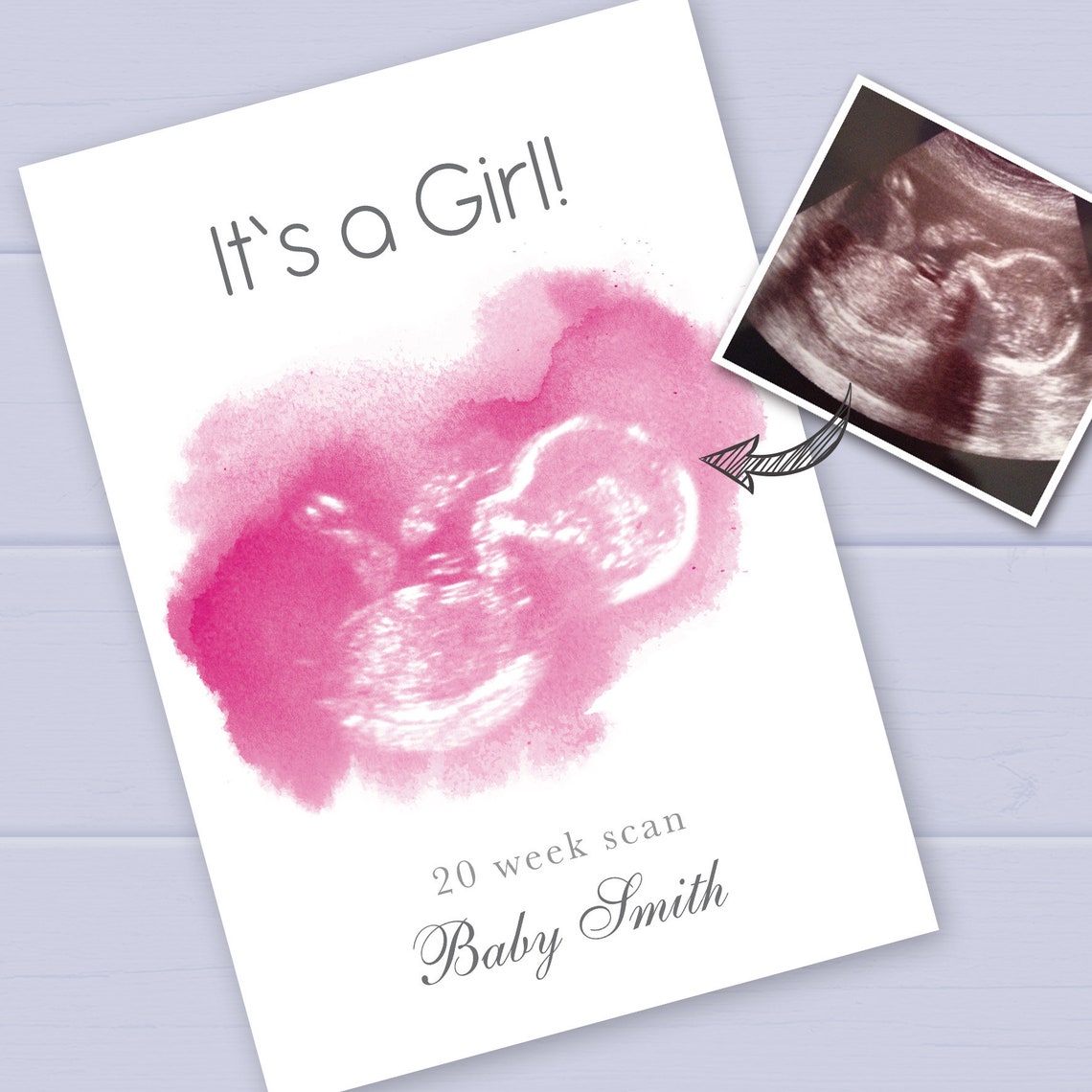 Baby scan print. Ultrasound or Sonogram Art print. Baby Scan | Etsy