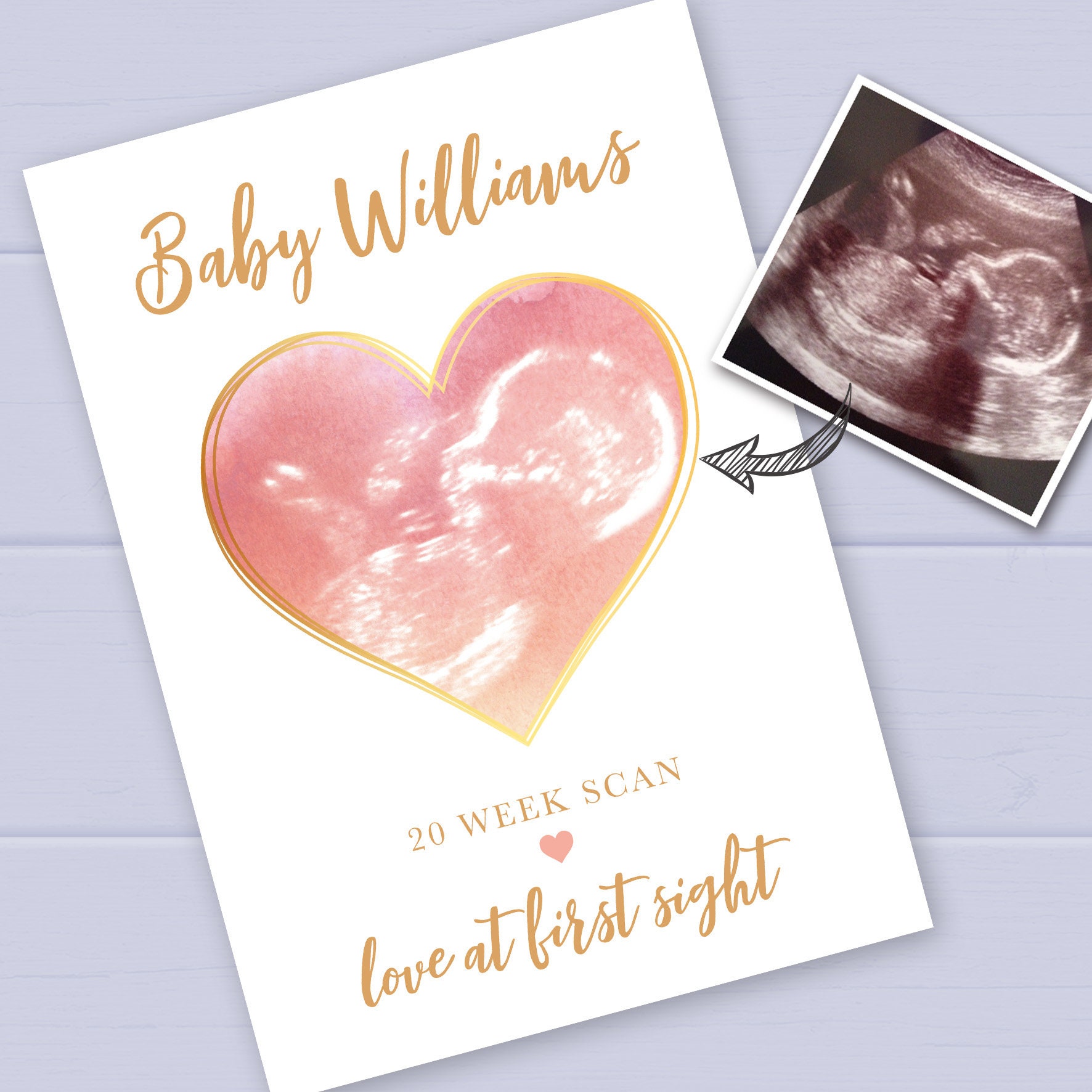 Personalised Watercolour Baby Scan Print. Baby Brunch Gift for - Etsy.de