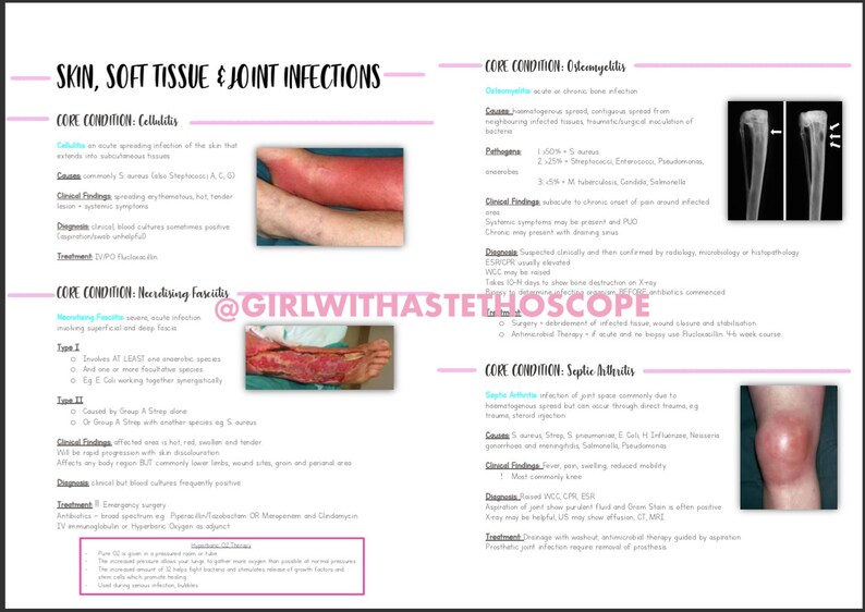 Infectious Diseases Notes Bundle - Etsy