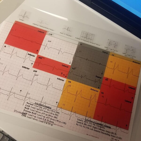 Ekg - Etsy