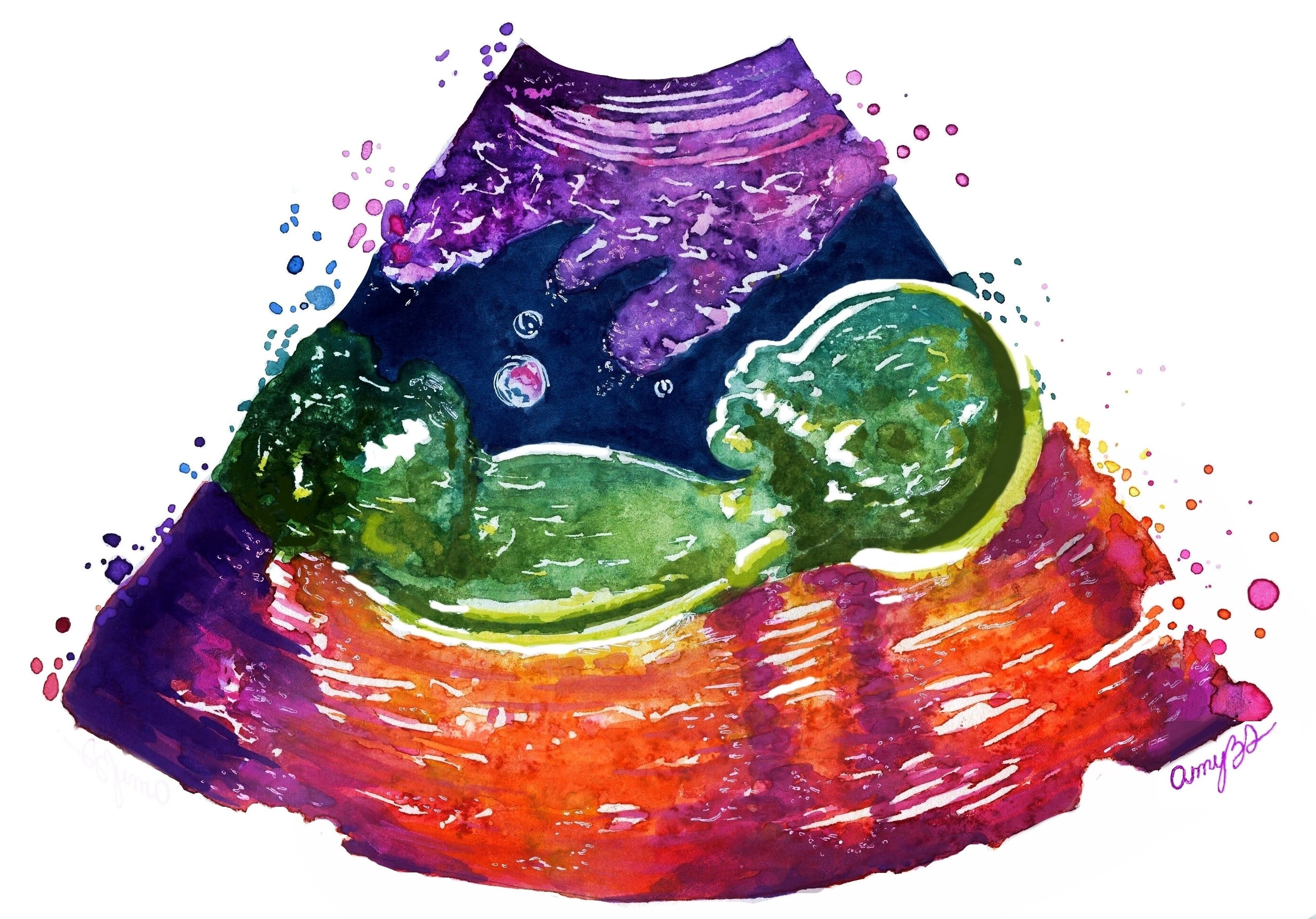 Custom Baby Ultrasound Painting, Fetal US Watercolor Art, Baby Shower ...