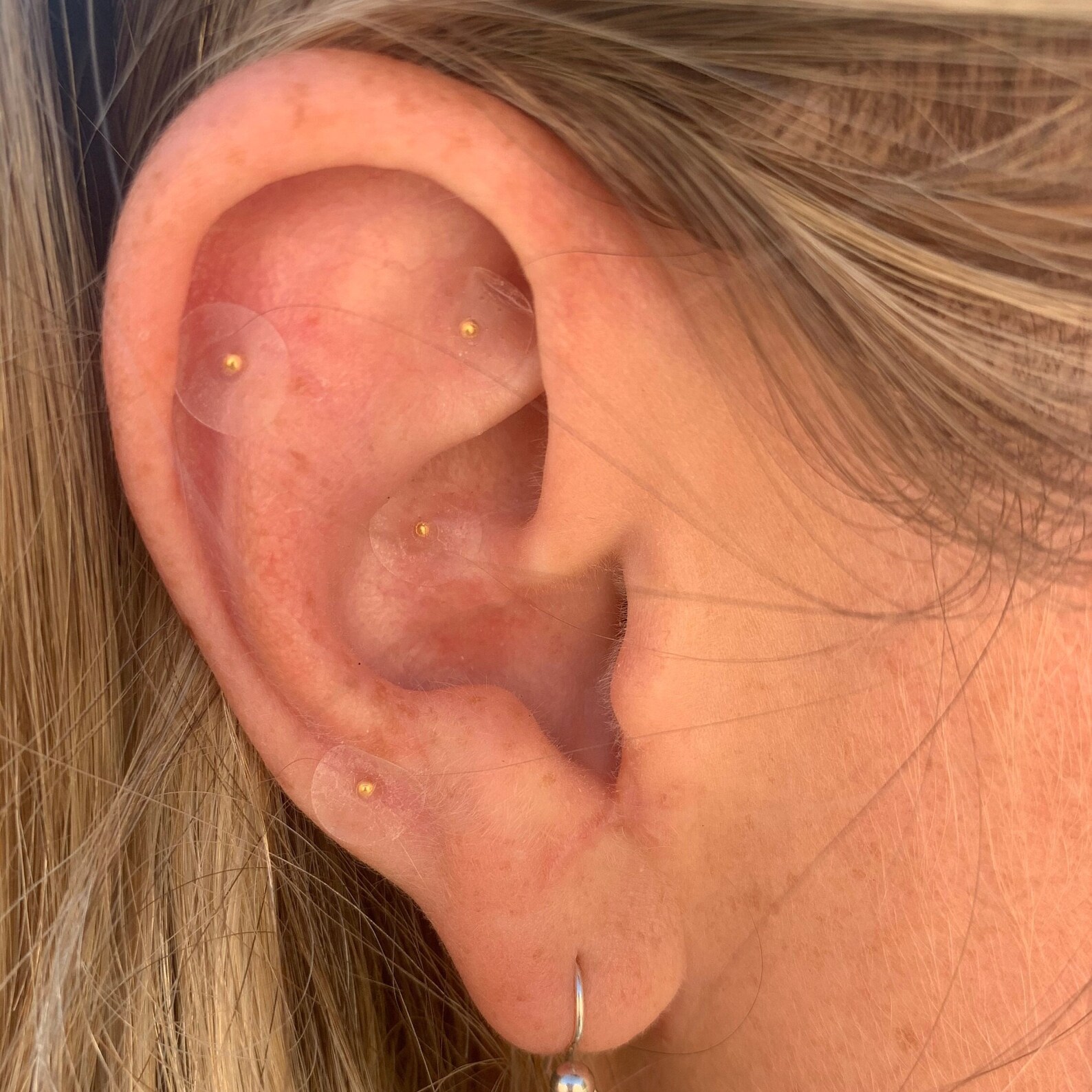 Tiny Gold Ear Seeds With Chart for Sleep & Insomnia. Acupuncturist ...