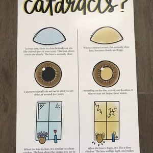 Cataract Educational Poster: Optometry Office Wall Decor - Etsy