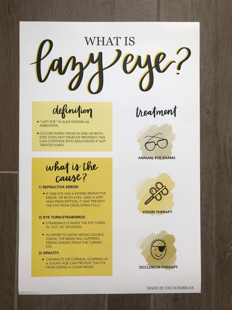 Amblyopia Poster: Lazy Eye Educational Chart - Etsy