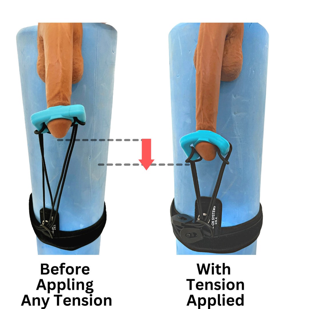 Penis Stretching Packages Under Clothing Ads Extender Stretcher By