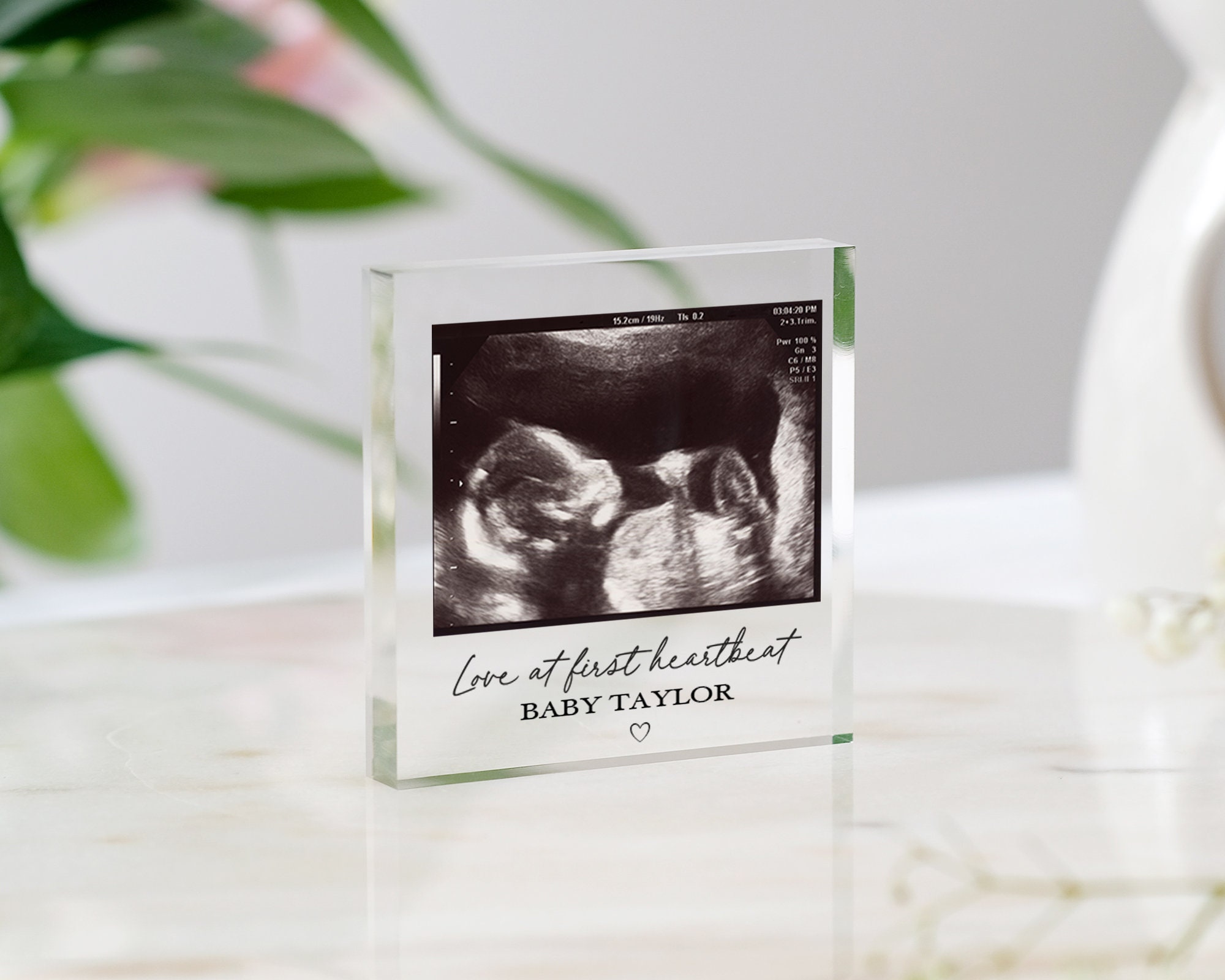 Baby Scan Photo Baby Scan Frame Baby Scan Gift | Etsy