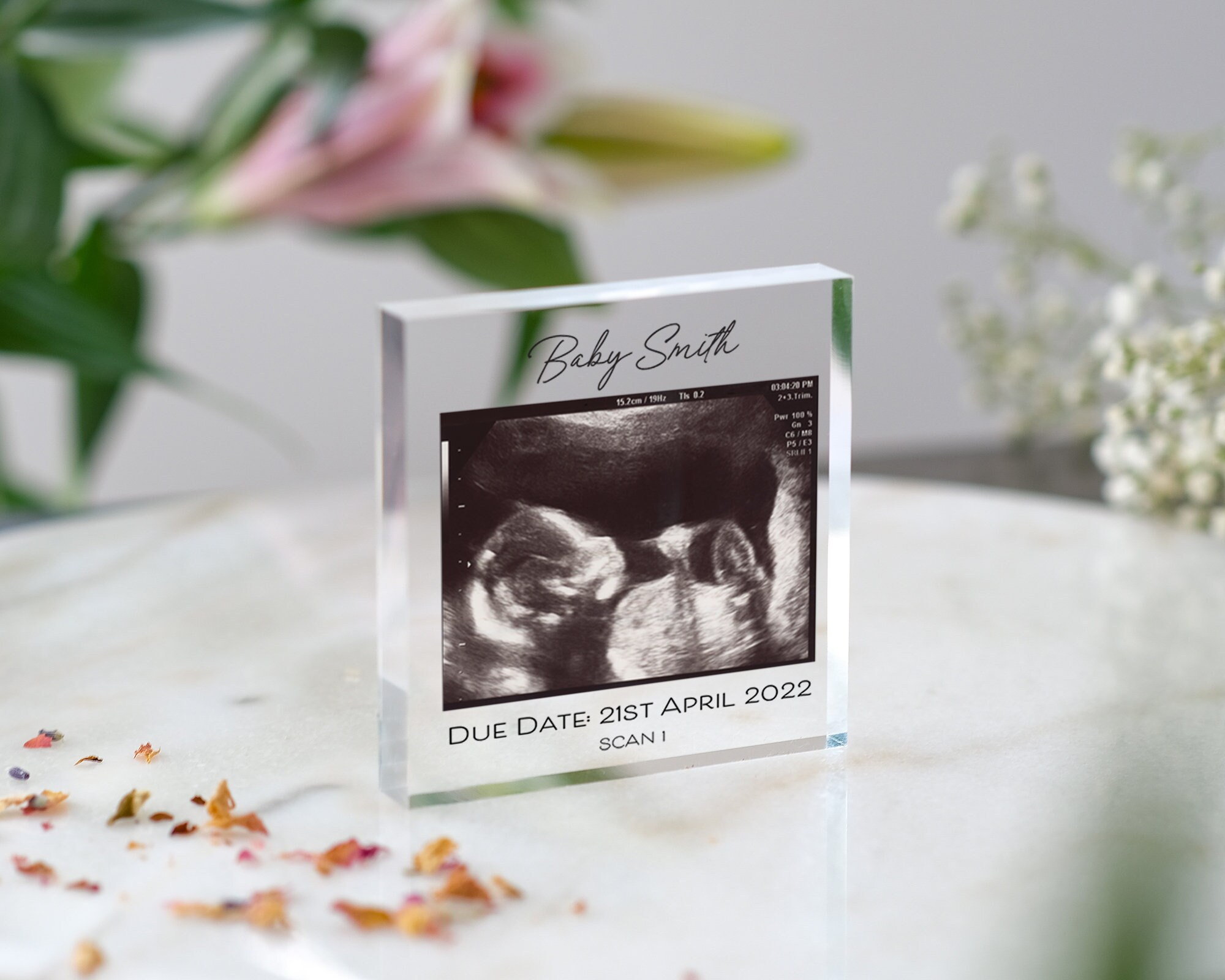 Baby Scan Photo Print Baby Scan Frame Baby Scan Gift for - Etsy