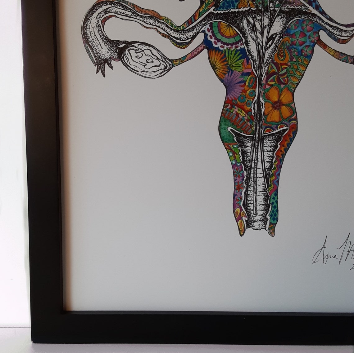 FEMALE REPRODUCTIVE SYSTEM 5 X 7 8 X 10 or 11 X - Etsy