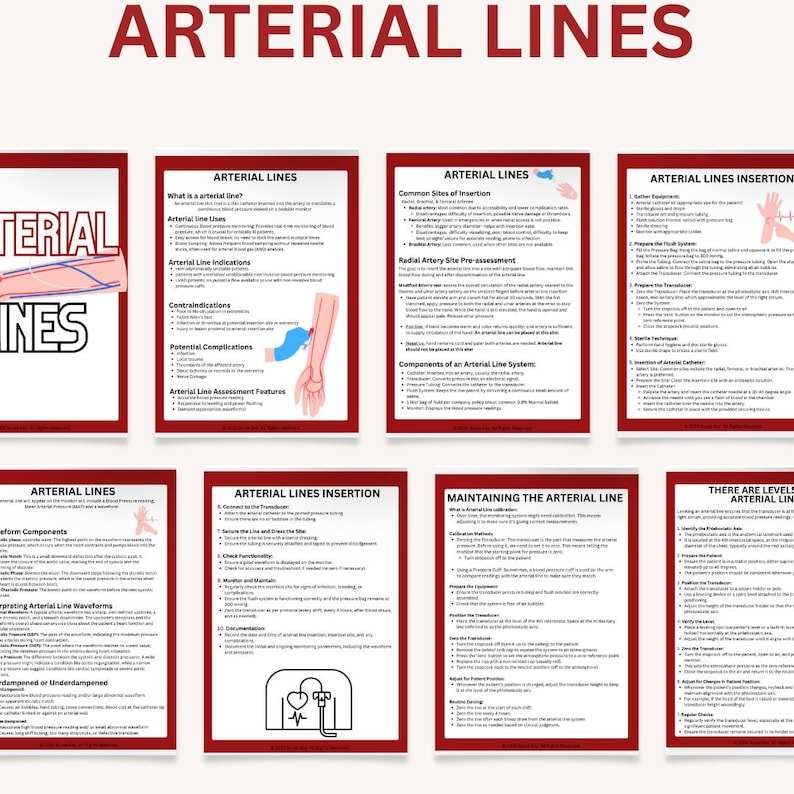 Arterial Lines Printable - Etsy