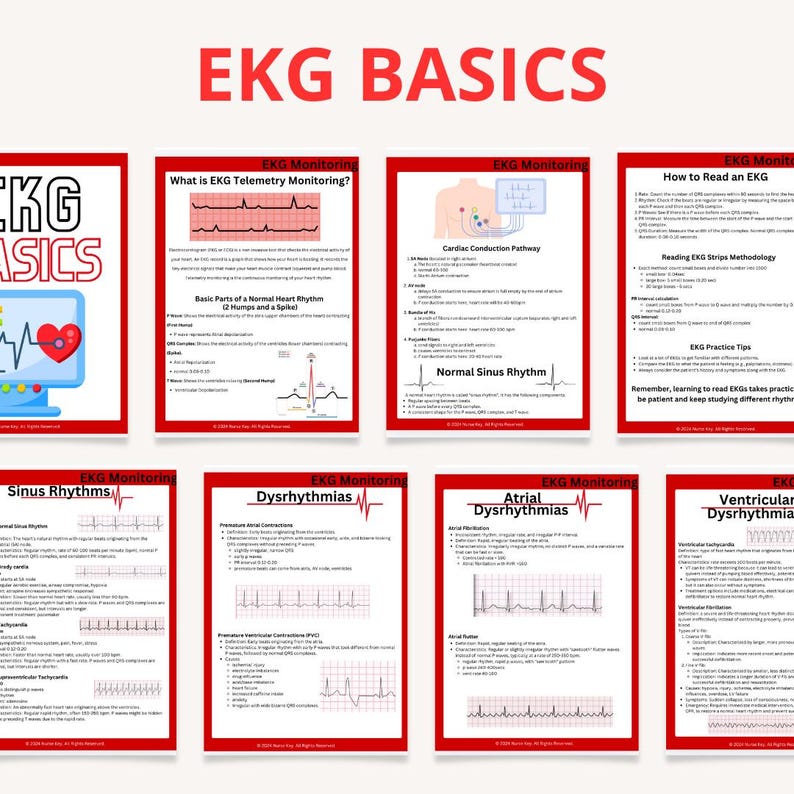 Rhythm Nation: the Nurse's Guide to EKG Basics Ebook - Etsy
