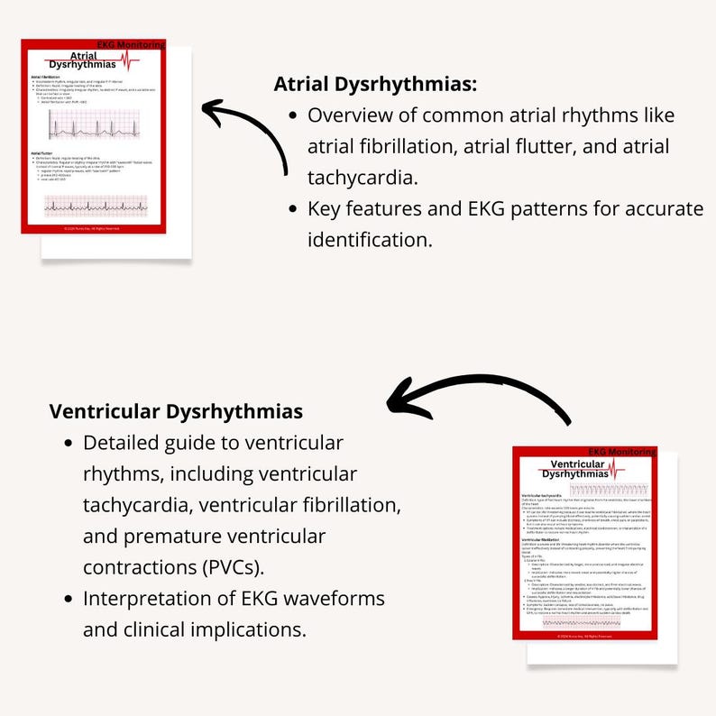 Rhythm Nation: the Nurse's Guide to EKG Basics Ebook - Etsy